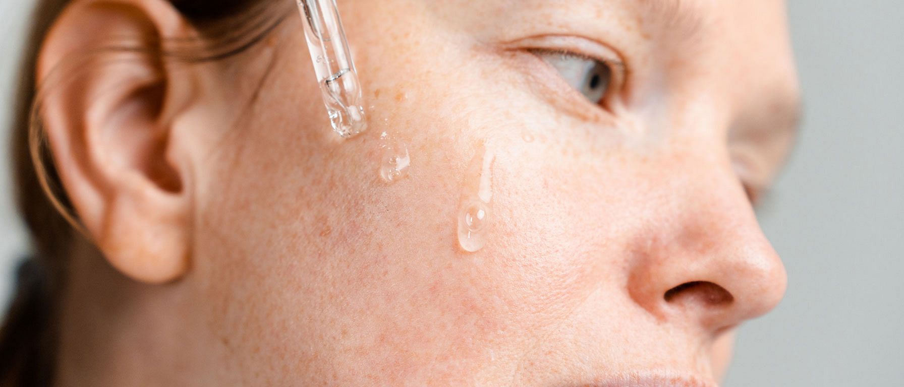 Ursachen von Pigmentflecken und was du tun kannst